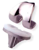 Total Knee Replacement